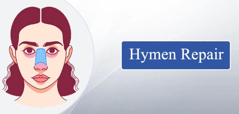 Hymenoplasty in Jaipur | Hymen Reconstruction Surgery | Cosmo-Hair