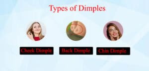 Dimple Creation in Jaipur | Dimpleplasty Surgery at Cosmo-Hair